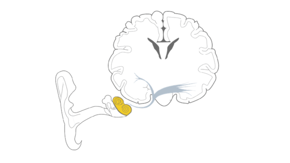 The 3 Types of Hearing Loss: Conductive, Sensorineural and Mixed